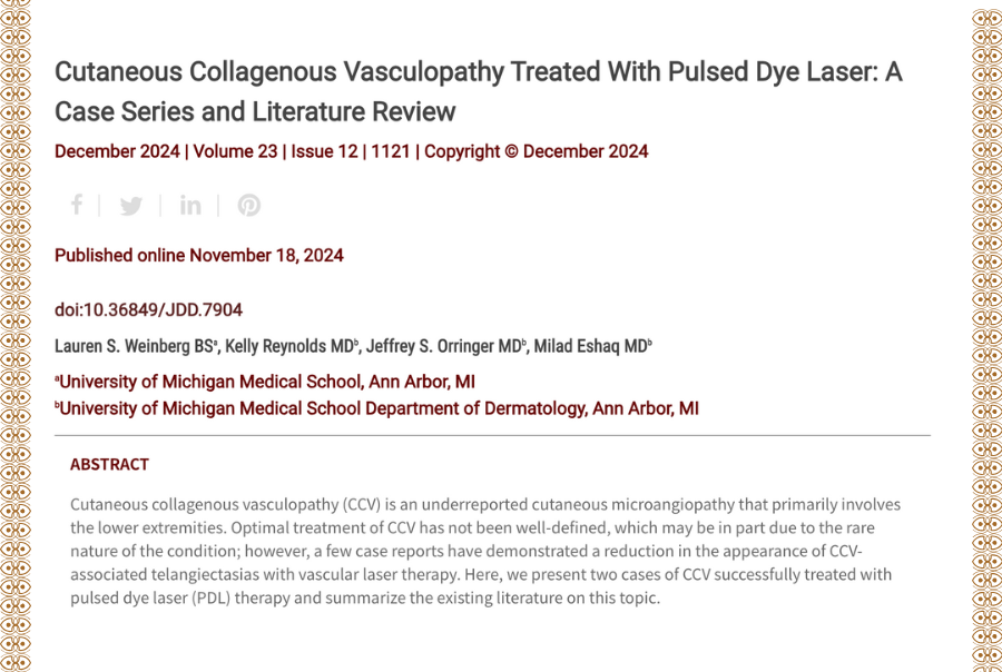 Cutaneous Collagenous Vasculopathy Treated With Pulsed Dye Laser: A ...
